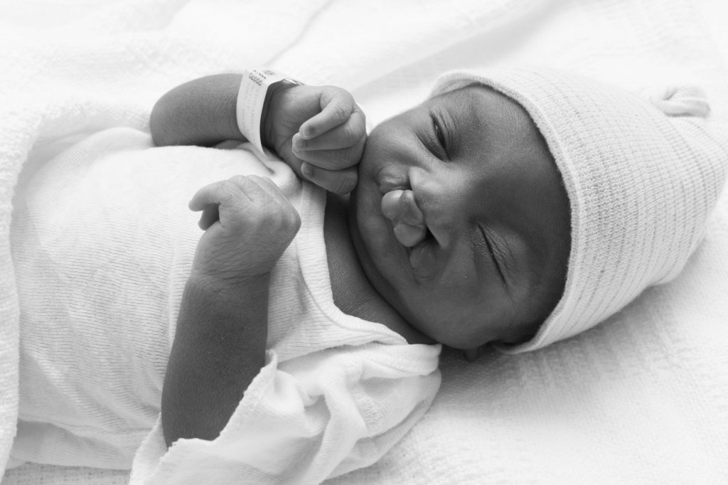 UNDERSTANDING TRISOMY 18 – The E.WE Foundation